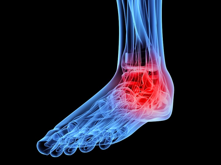 Aquí tiene los 10 mejores remedios caseros para el dolor de pie ...