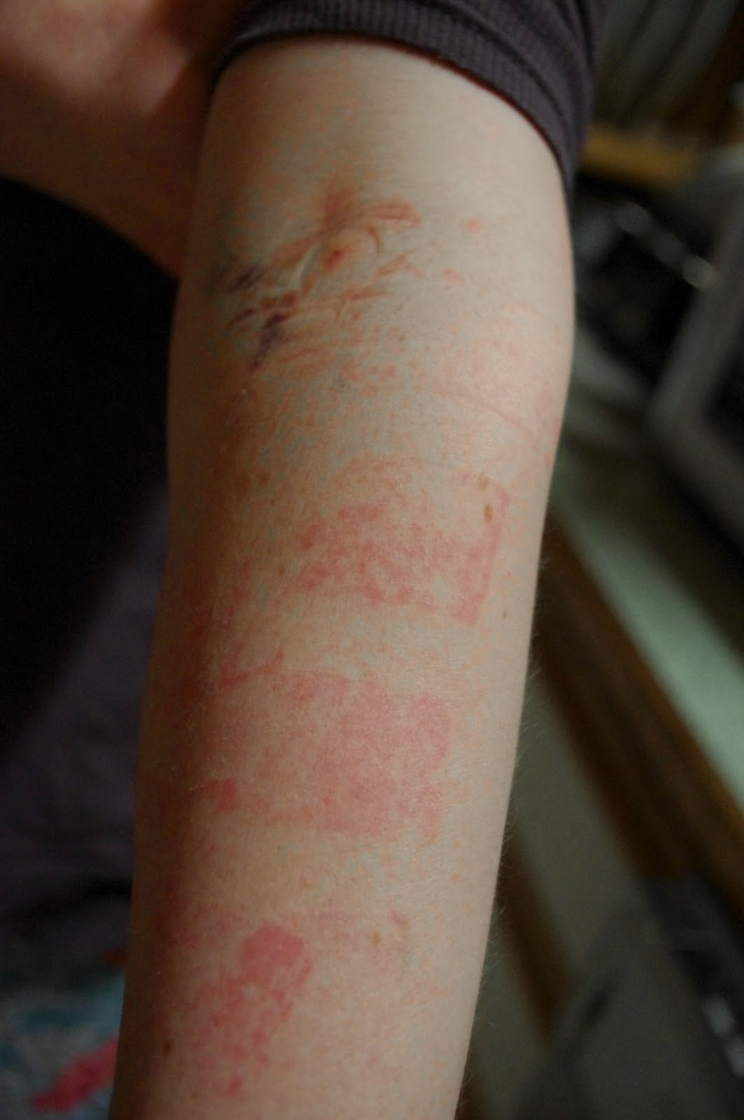 Living with Bob (Dysautonomia): "OMG! That is weird". Or is it?