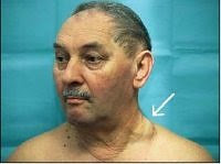 GESEM: Setembro 2011