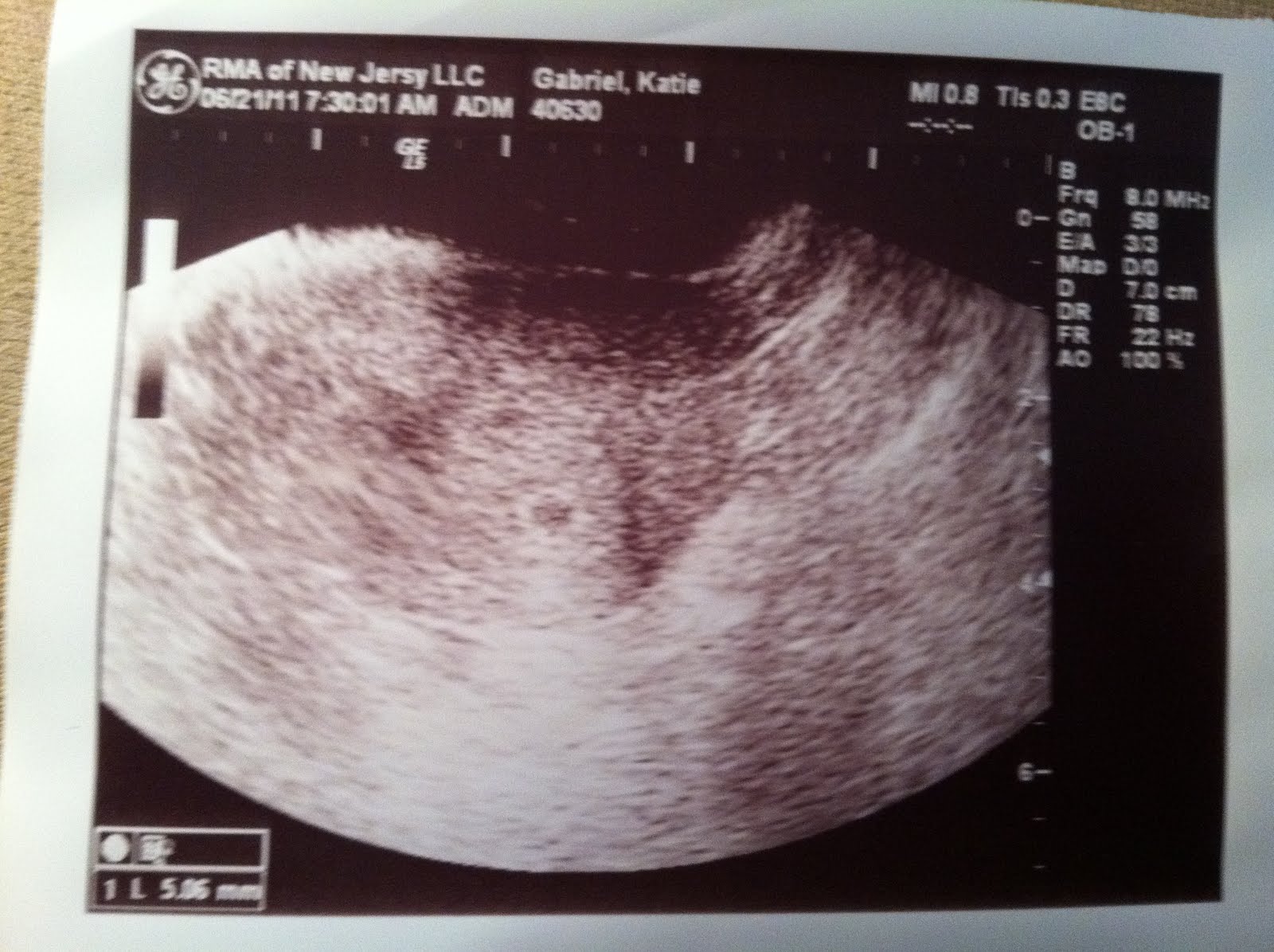 Dear Hope: Ultrasound Pictures