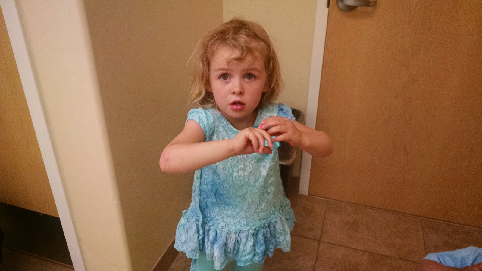 Discoveries: Julia Get's Staples: Warning- Head Wound Images