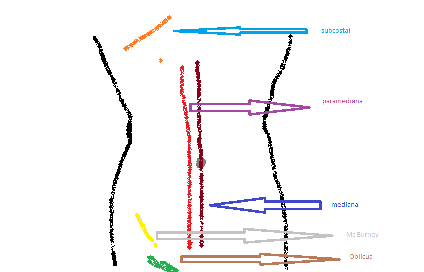 INCISIONES QUIRÚRGICAS ABDOMINALES