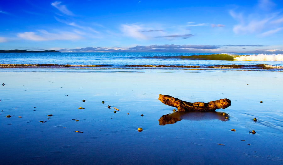 Lasik Eye Surgery Laser Eye Surgery Custom Lasik