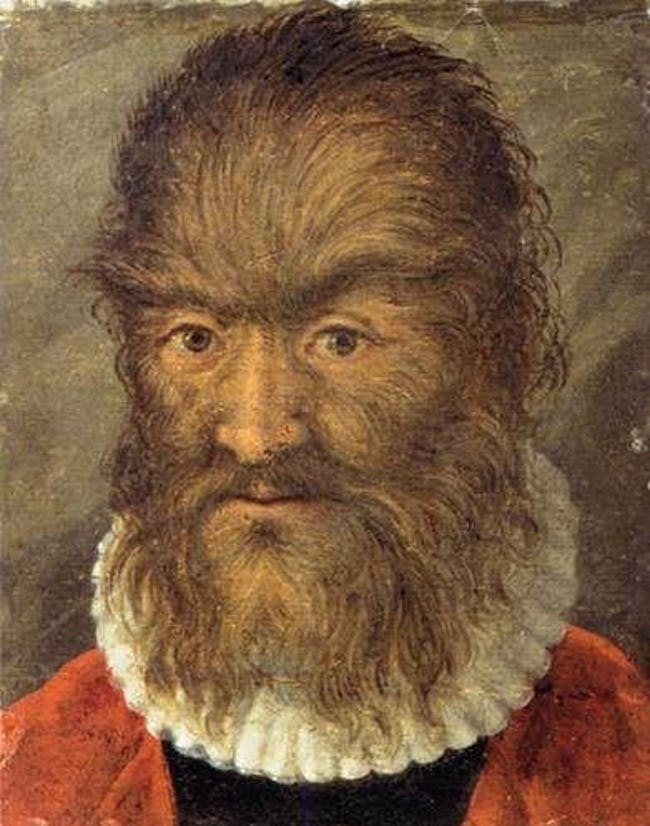 Cuplul real care a inspirat „Frumoasa și bestia” a dus o viață extrem ...