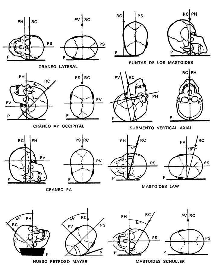 Tecnicos Radiologos: Posiciones Radiografia de Craneo