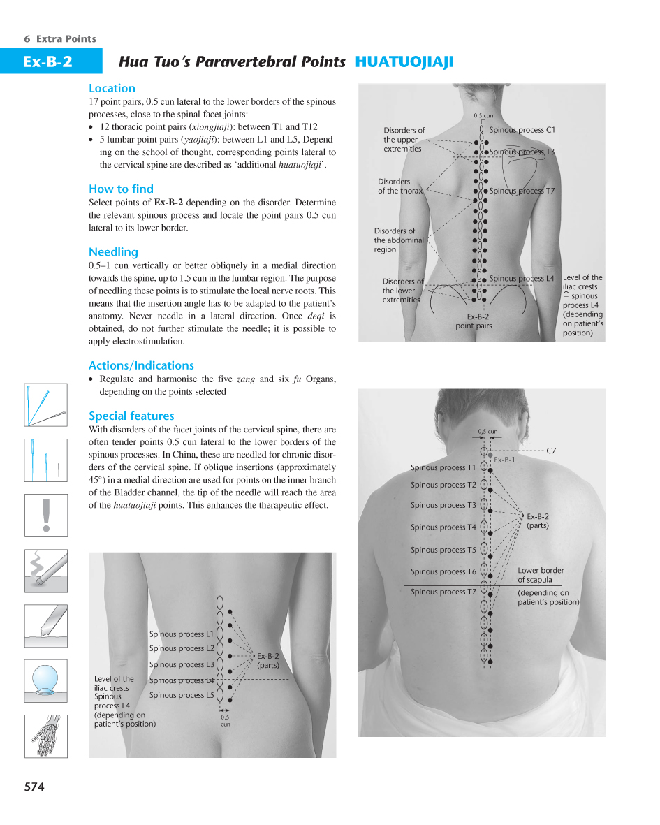 Acupuncture Masters: Acupuncture Points Database - Extra Points