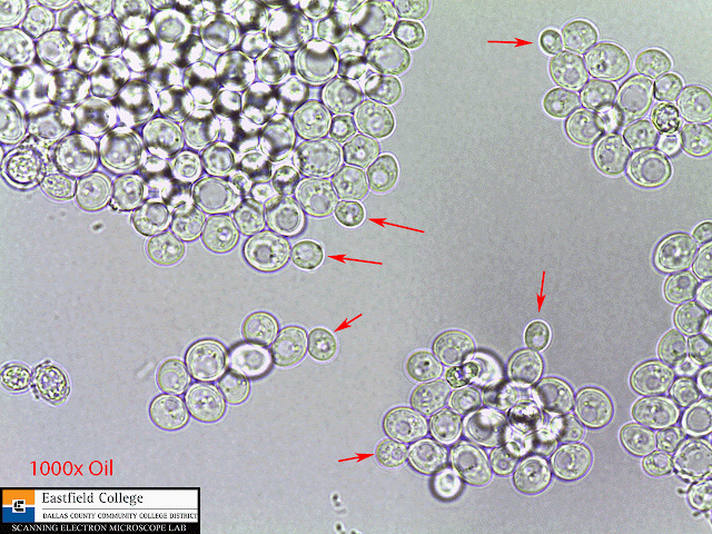 Scanning Electron Microscope Blog: A Few More Fungi