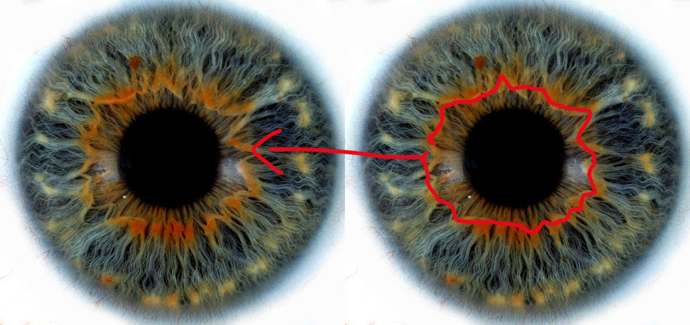HUMAN IDENTIFICATION BASED ON IRIS DETECTION TECHNOLOGY