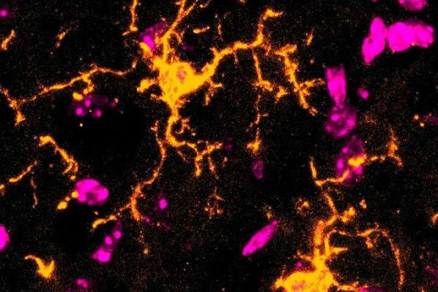 Our Parkinson's Place: Microglia react distinctively during inflammation