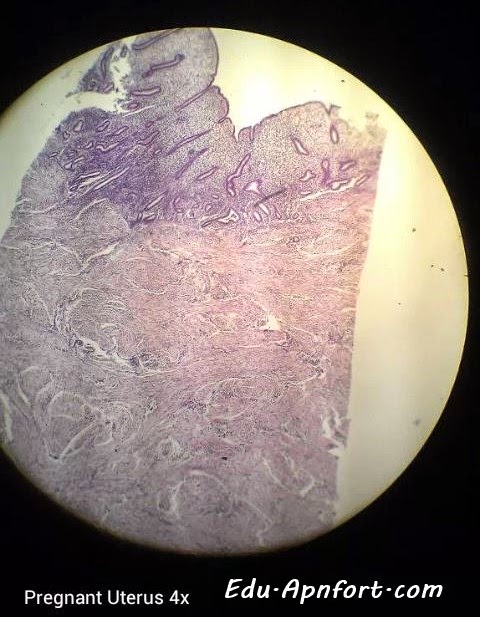 Educational Blog : Uterus slides