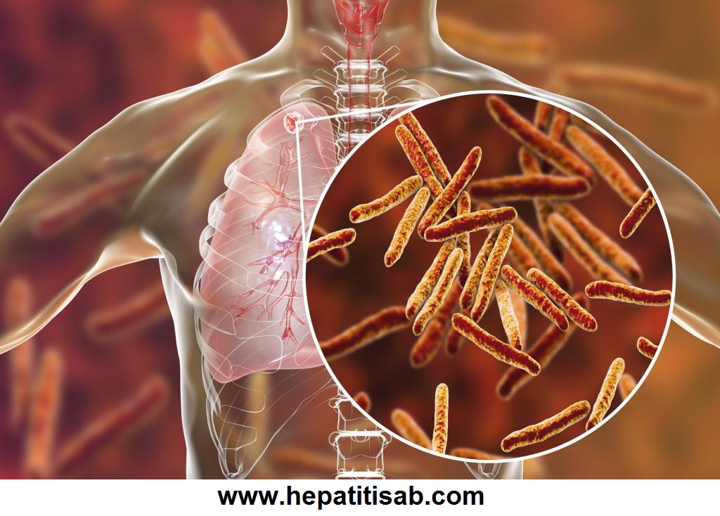 What is Bone Tuberculosis Treatment