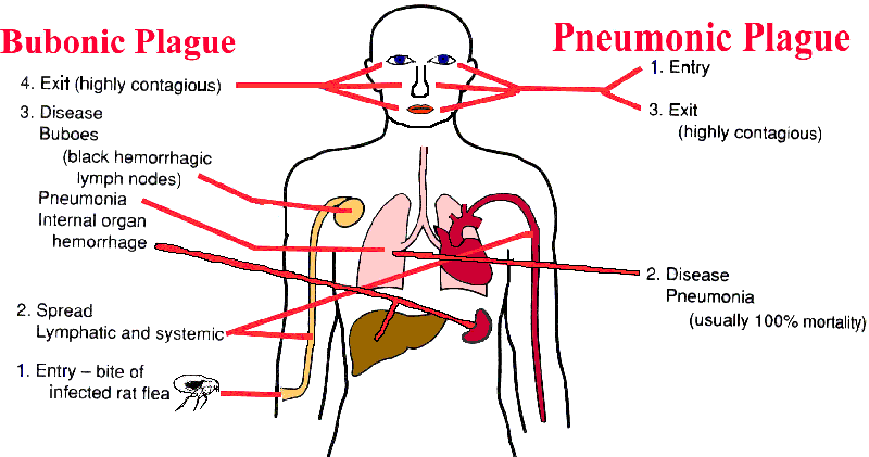 sikkahoder: Penyakit Sampar (plague) : Penyebab, gejala dan Pengobatan