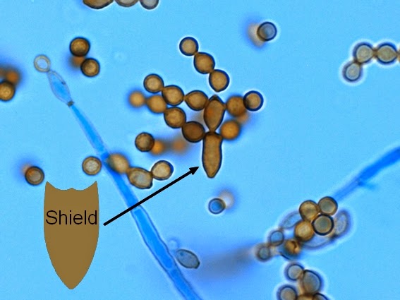 Fun With Microbiology (What's Buggin' You?): Cladosporium species ...