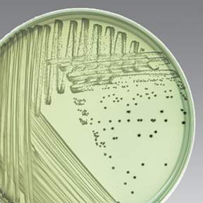 My Simple blog: MACAM-MACAM MEDIA PADA BAKTERIOLOGI