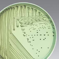 My Simple blog: MACAM-MACAM MEDIA PADA BAKTERIOLOGI