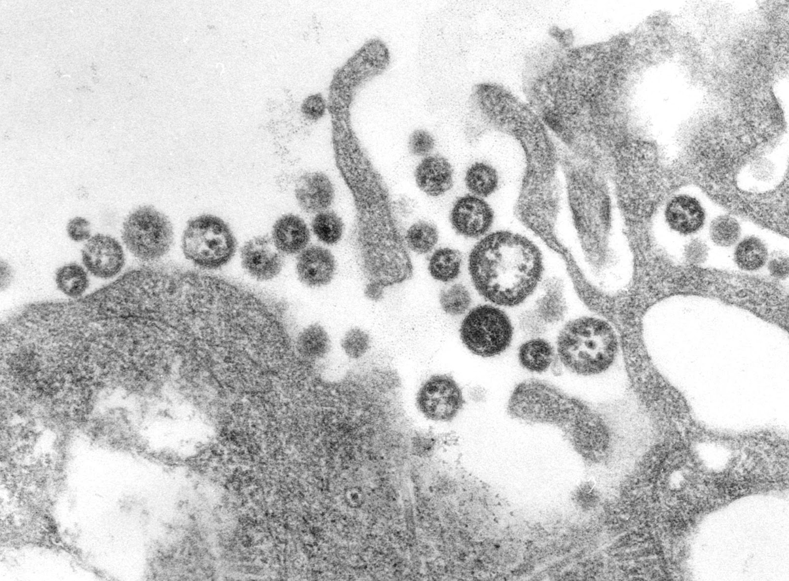 Virus Junin; Virus de la Fiebre Hemorrágica Argentina