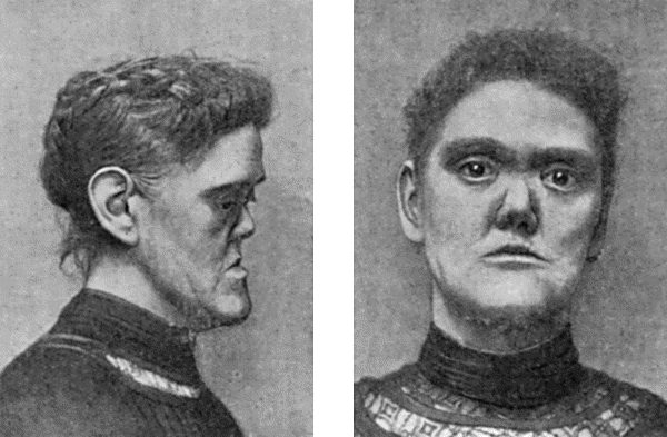 Deformutilation: Manual of Surgery