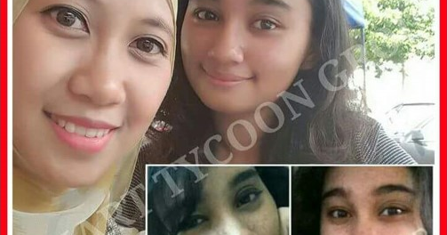 Jerawat Mengecut Dalam 2 Minggu