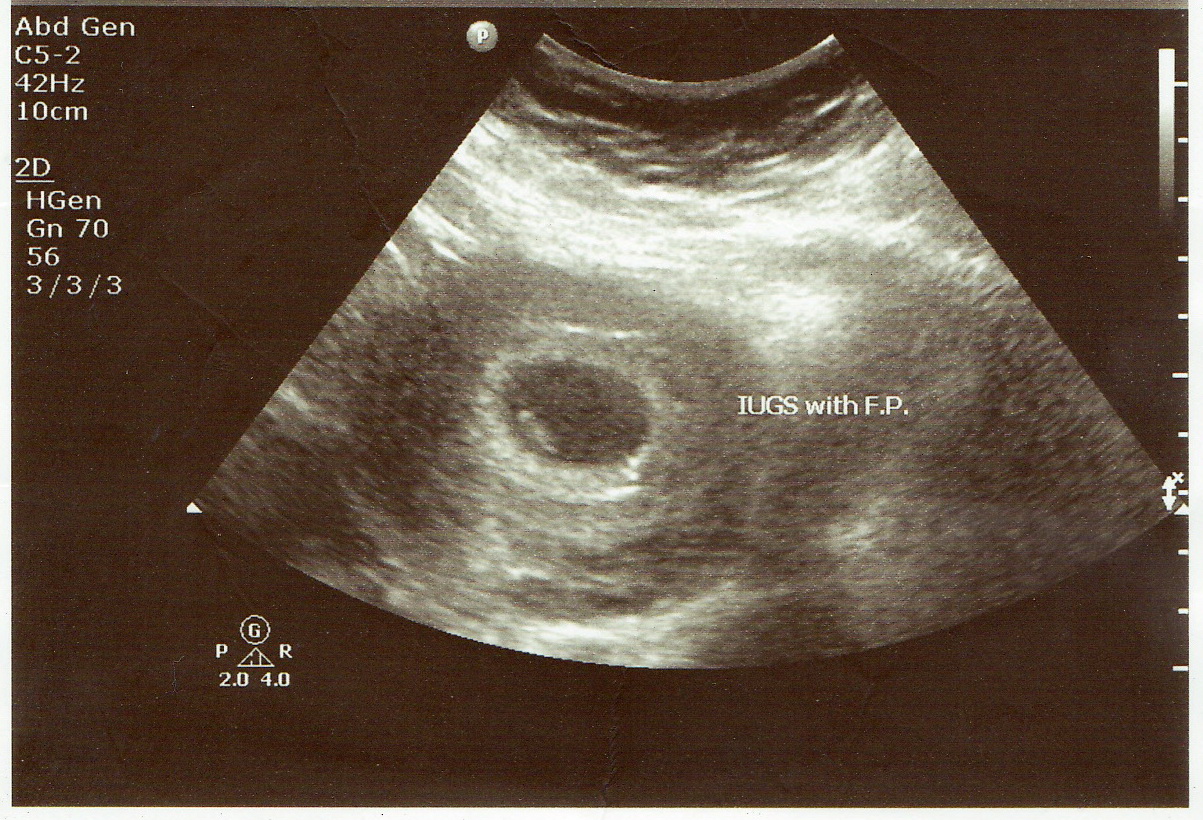 Ultimate Radiology : March 2013