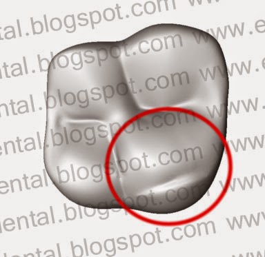 Características anatômicas do primeiro molar superior direito Dente 16