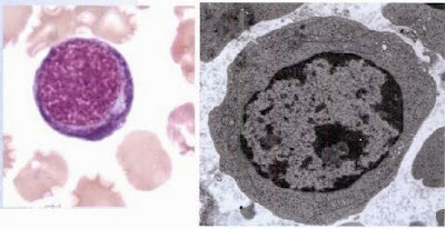 HEMATOLOGIA: PROERITROBLASTO