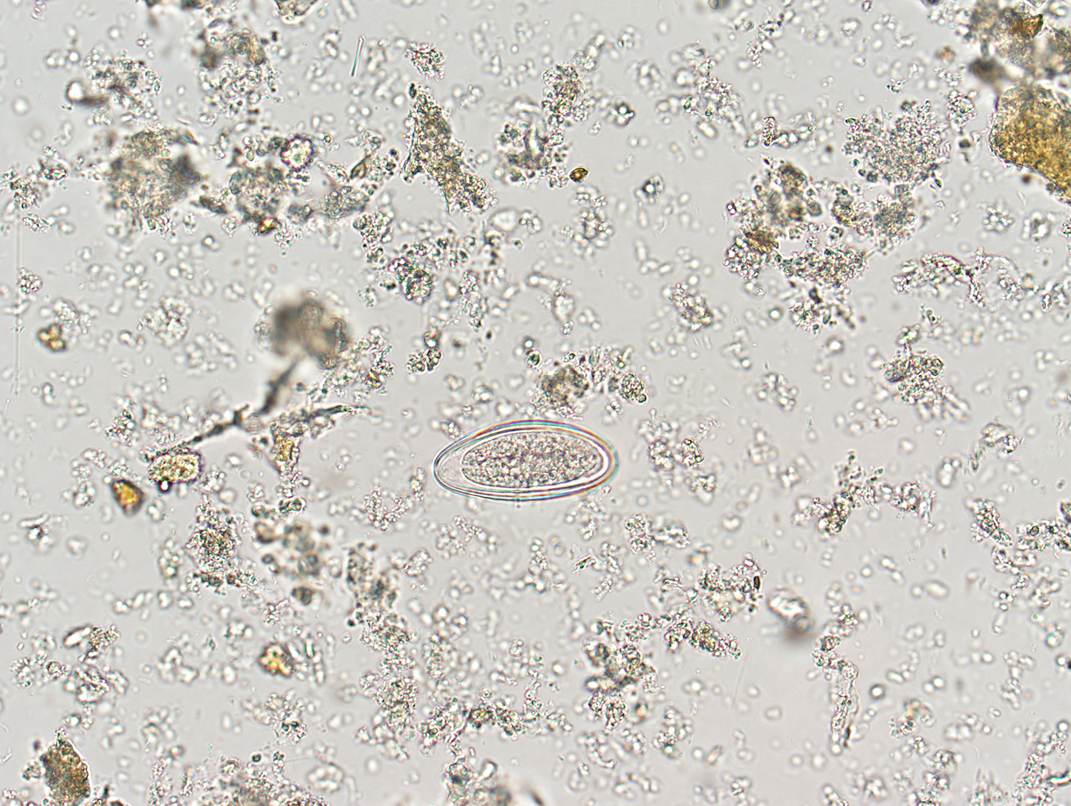 Creepy Dreadful Wonderful Parasites: Case of the Week 434