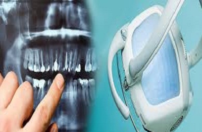 dental x ray: Routine Cleaning