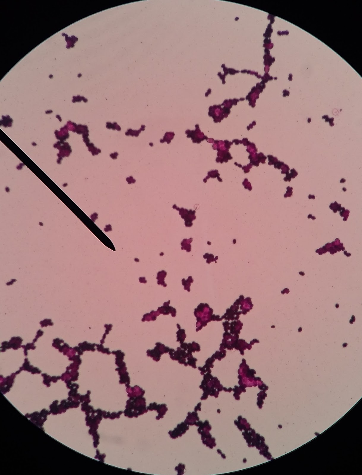 Rincón de Micología: Saccharomyces cerevisiae
