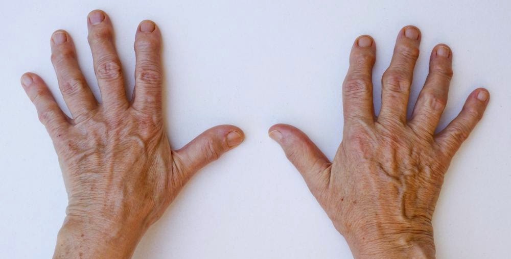 Ce que tu cherche : Quelles sont les causes de la raideur matinale?