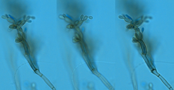 Fun With Microbiology (What's Buggin' You?): Fonsecaea pedrosoi/monophora