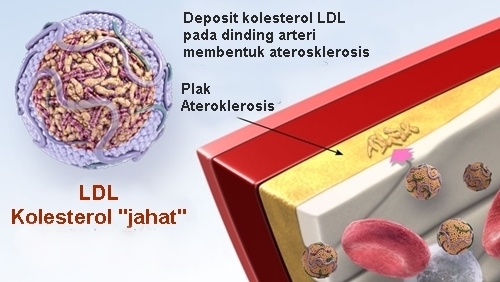 Kolesterol Baik (HDL) Dan Kolesterol Jahat (LDL)