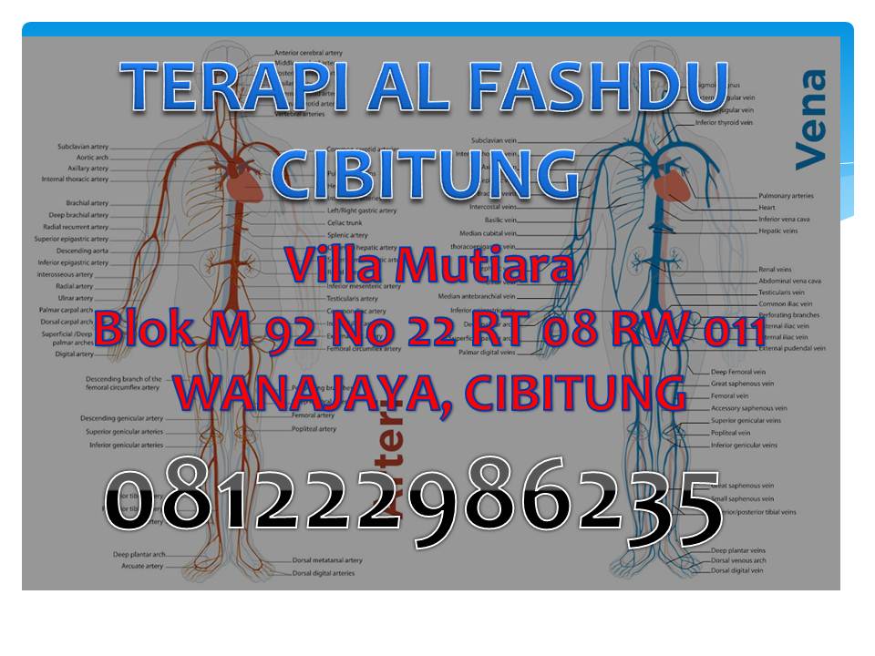 TERAPI SEHAT AL FASHDU Pak Hanif Cibitung 081222986235