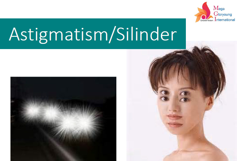 Mata Silindris - INOVASI TEKNOLOGI KESEHATAN