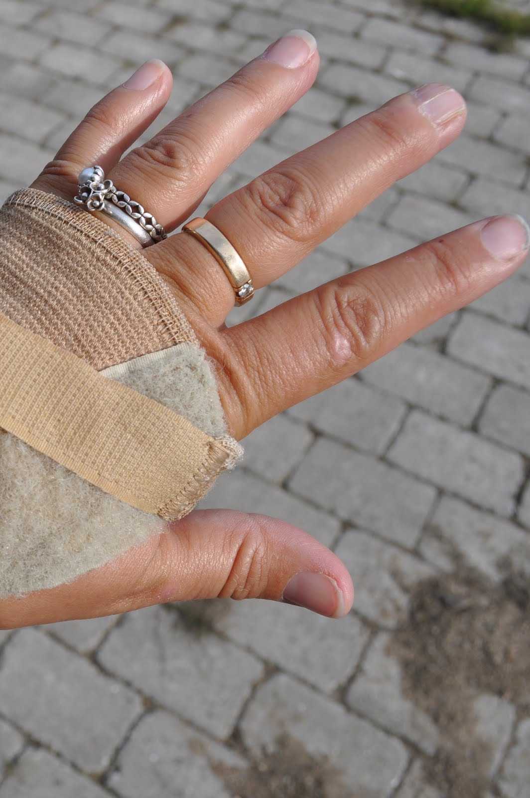 AM´strik: Ondt i håndledet....