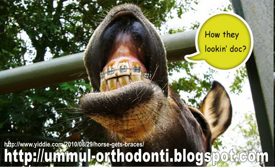 O R T H O D O N T I: Kawat Gigi Kuda (Biasanya Kacamata Kuda)