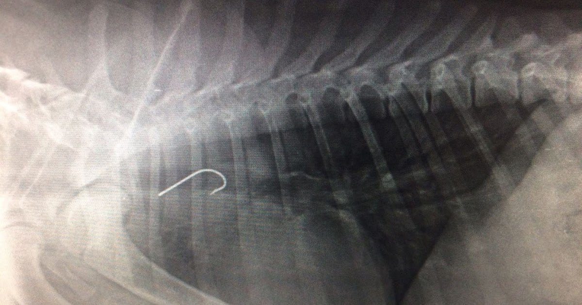 BLOG DE VICENTE PEÑA: Anzuelo en esófago torácico: esofagotomía de urgencia