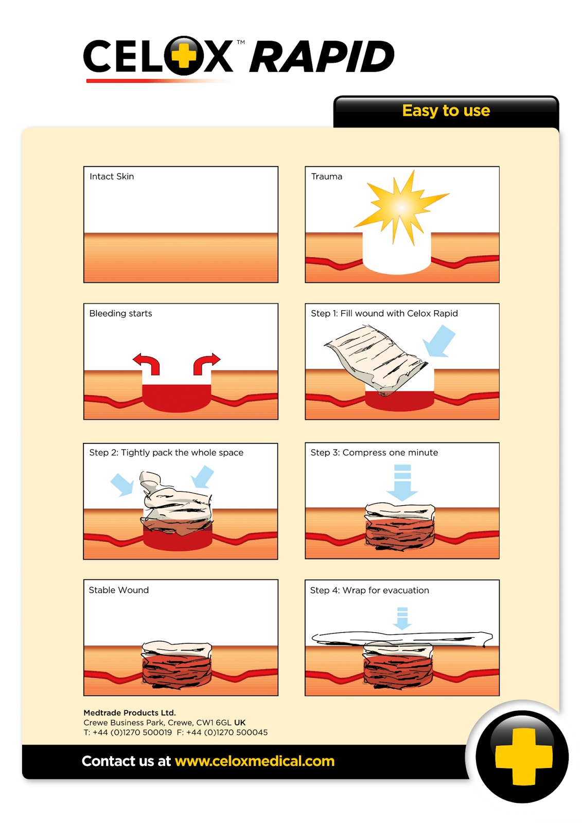 EMS SOLUTIONS INTERNATIONAL by @DrRamonReyesMD marca registrada: CELOX ...