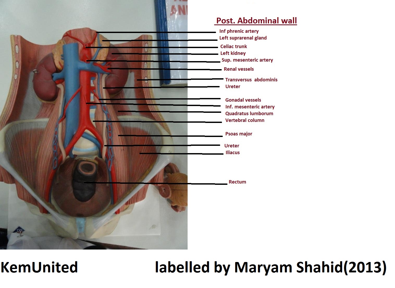 Abdominal Model Labeled at Alice Pace blog