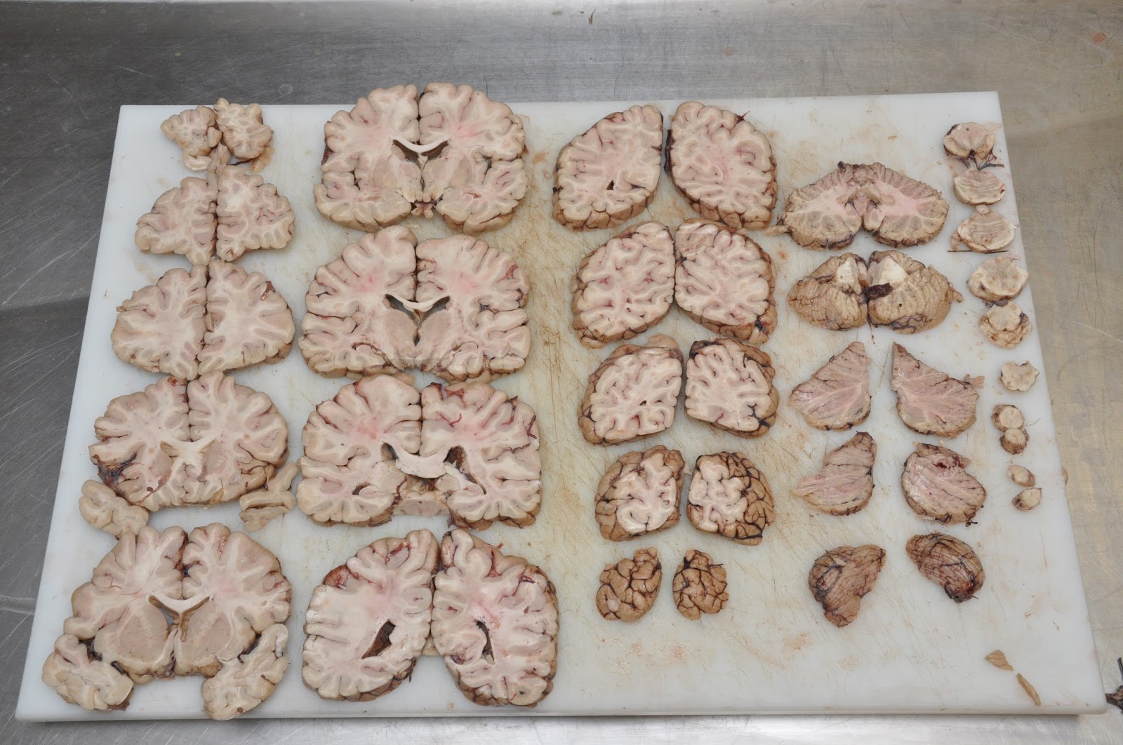 neuropathology blog: The Mercado Brain Cutting Device launched at the ...
