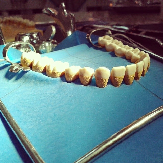 Odontôligado: Isolamento absoluto, saiba quais as vantagens e que ...