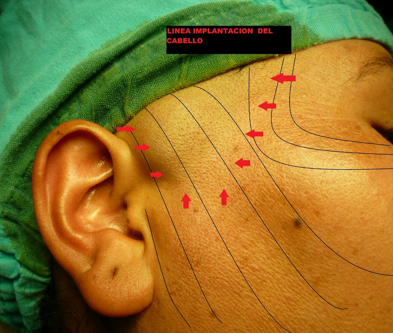 Revision Casos De Cirugia General