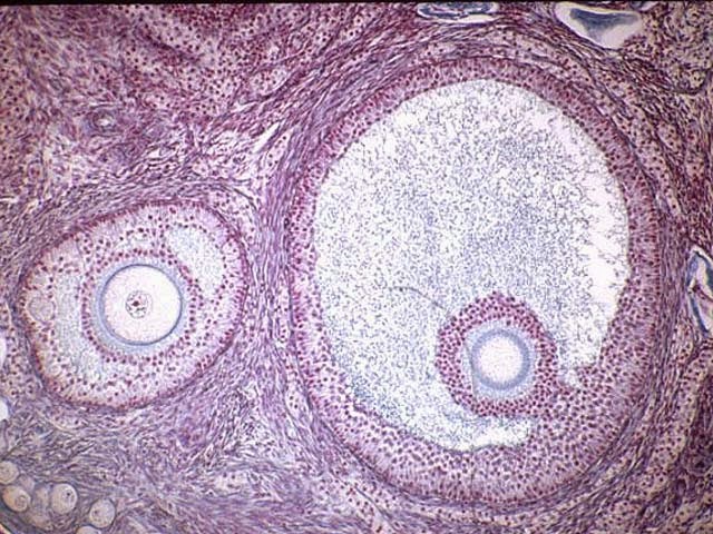Ciencias de Joseleg: El folículo de Graaf