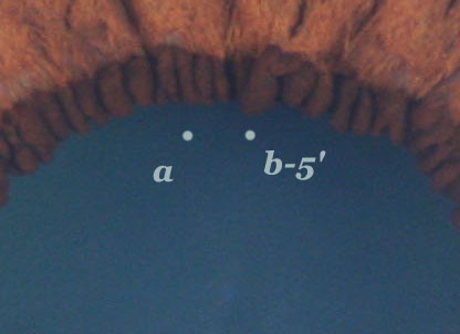 Modern & Multidimensional Iridology: Inner Pupillary Border - Rx - (tani)