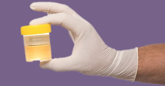 COLLECTING A MIDSTREAM URINE SPECIMEN ~ Nurses Guide