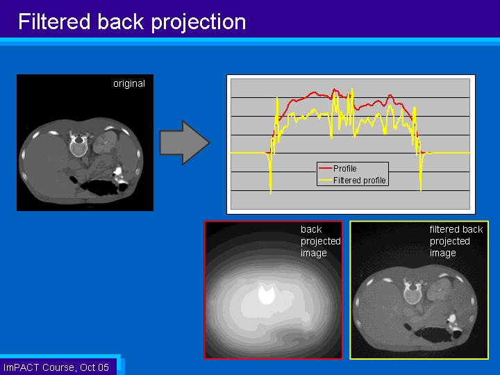 Basic principles of CT scanning ~ ct.scan.