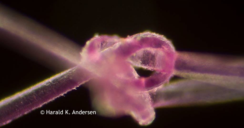 Microscope World Blog: Hair Under the Microscope