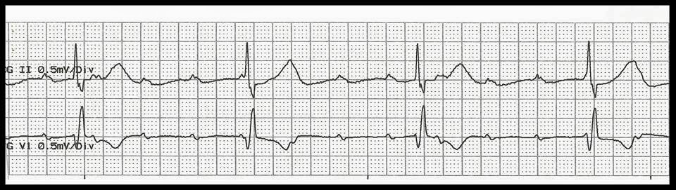 Practice Rhythm Strips 298