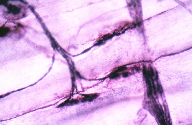 el moderno prometeo: Breve aproximación a la fisiología muscular.