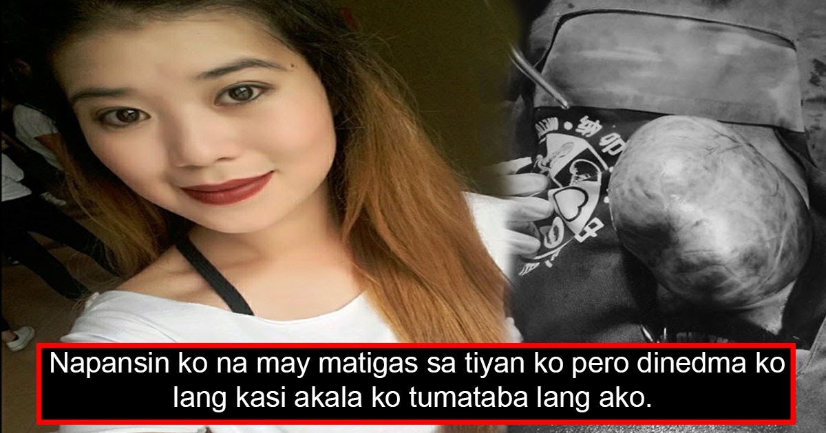 Napansin Niya Na May Matigas Sa Kanyang Tiyan At Inakala Na Tumataba Lang Siya Pero Heto Pala ...