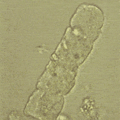 .: Examen Microscopico